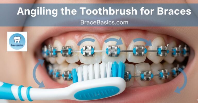 How to Brush Teeth with Braces (Complete Guide) - bracebasics.com