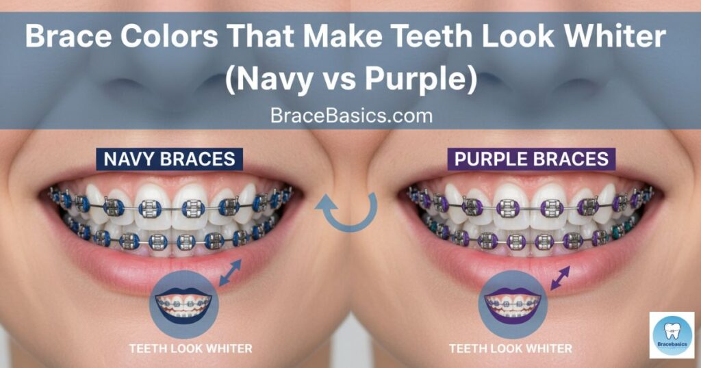 What Color Braces Should I Get? A Complete Guide to Choosing the Right ...