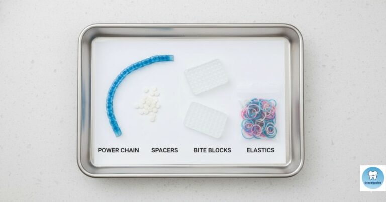Parts of Braces: 10 Powerful Components You Must Know for a Perfect ...